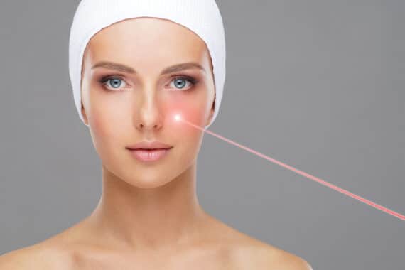 Types of Laser Skin Resurfacing: Choosing the Best Laser Therapy