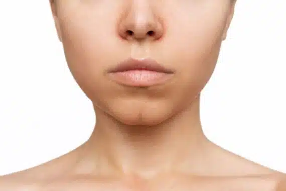 How to Get Rid of Cleft Chin? | Kam Facial Plastic Surgery
