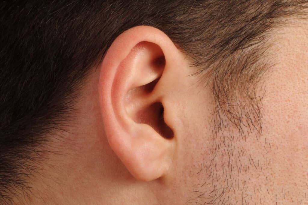 Fix Cauliflower Ear with Otoplasty in New Jersey | Dr. Kam